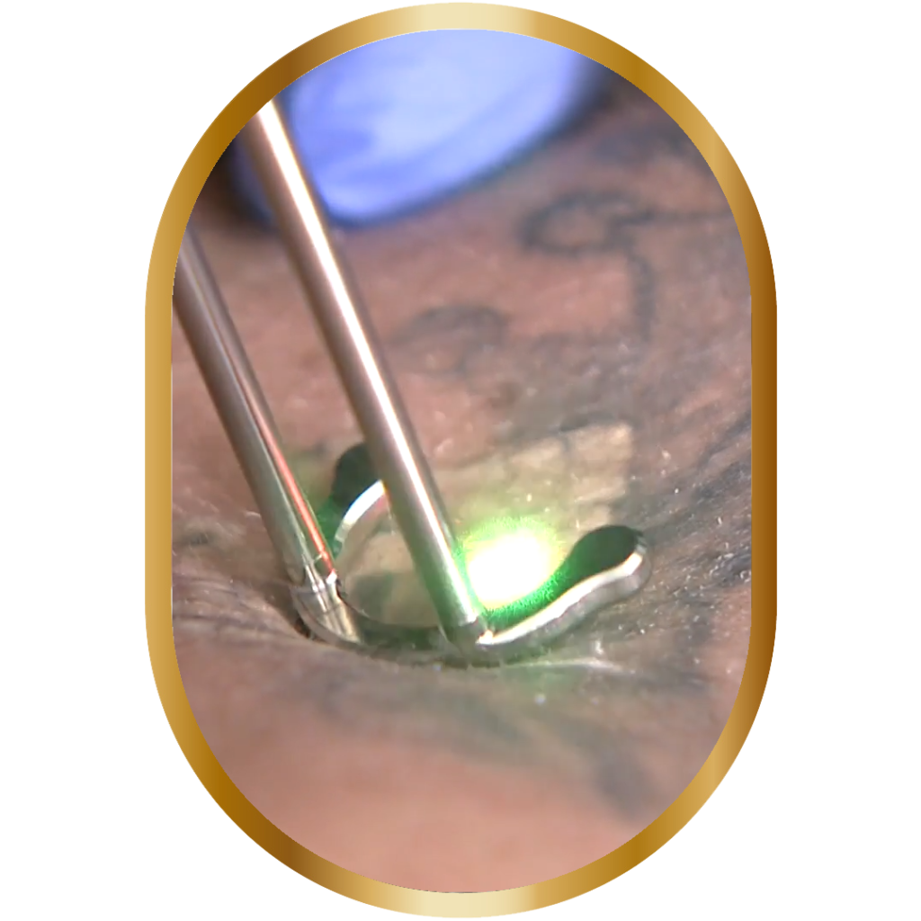 Services Archive - Page 2 of 3 - THE RITZ CLINIC เดอะริทซ์ คลินิก